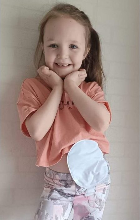 Meet the Liverpool schoolgirl who is taking the stigma out of stomas ...